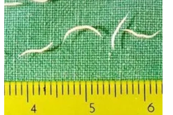 Threadworms In Children: The Symptoms And Treatment – Netmums - Netmums